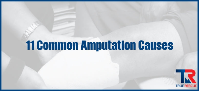 11 Common Causes of Amputation in the United States